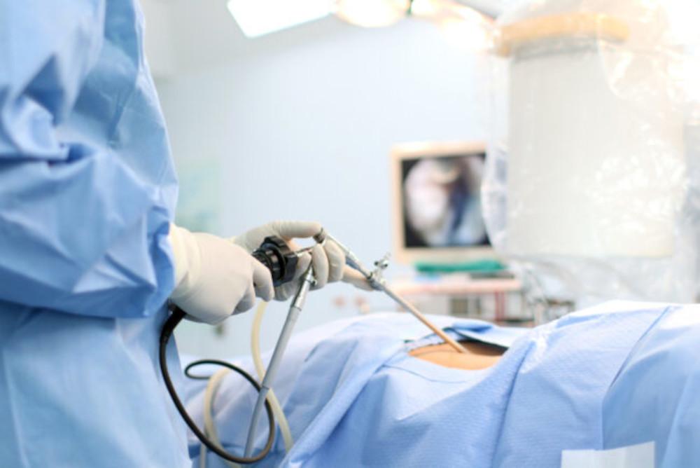 Anastomosis Usus: Definisi, Prosedur, Risiko, dll. - Hello Sehat