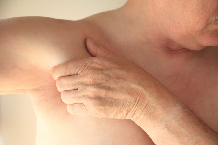 Eritrasma (Erythrasma): Penyebab, Pengobatan, dll. - Hello Sehat