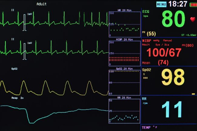 Cara Tepat Membaca Monitor ICU di Rumah Sakit - Hello Sehat