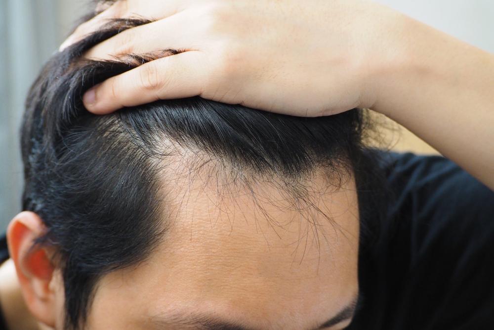 4 Proses Pertumbuhan Rambut dan Cara Menjaganya - Hello Sehat