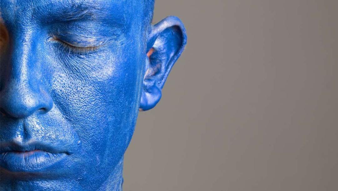 Argyria (Argiria): Gejala, Penyebab, Obat, dll. - Hello Sehat