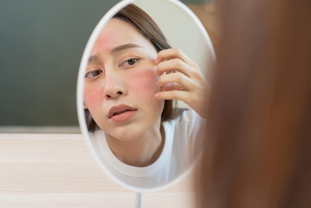 Skin Barrier Rusak: Ciri, Penyebab, Cara Mengatasi - Hello Sehat