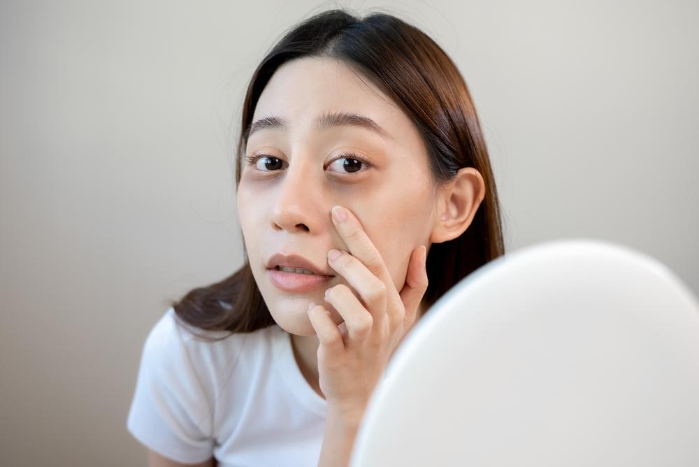 Mata Panda dan Kantung Mata, Apa Perbedaannya?