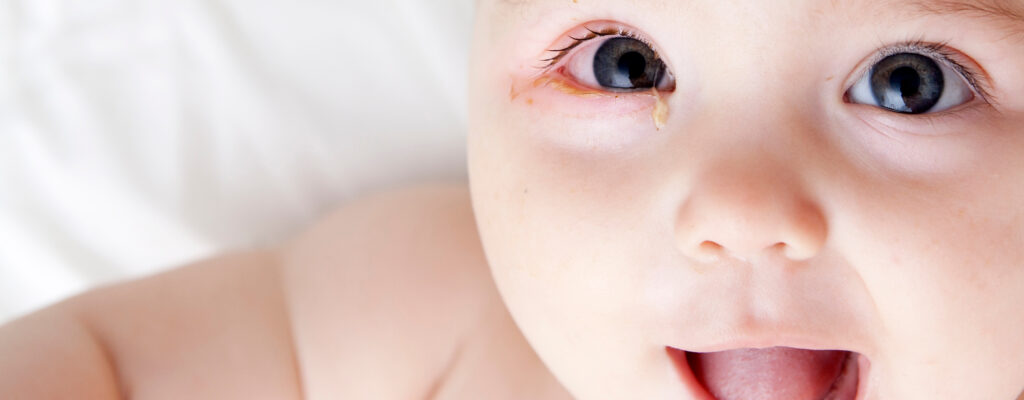 5 Penyebab Mata Bayi Merah dan Penanganannya - Hello Sehat