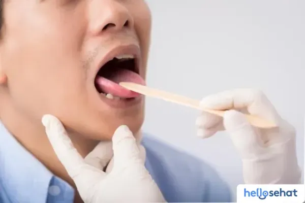 Warna Lidah yang Normal dan Tidak, Ini Bedanya - Hello Sehat