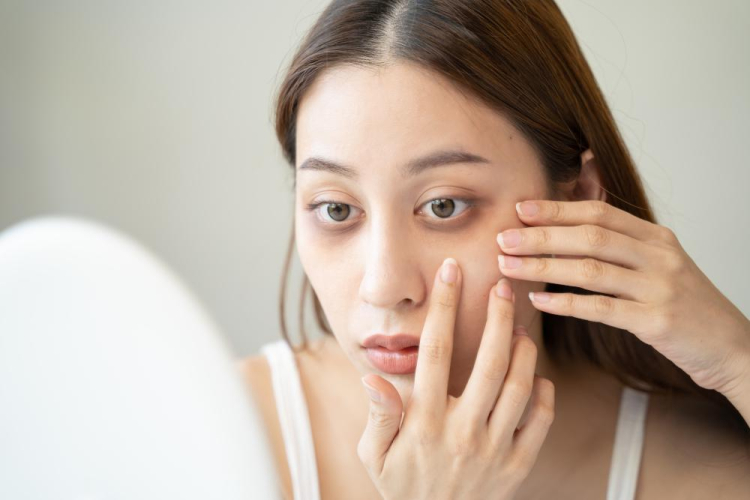 7 Penyebab Muka dan Kulit Tubuh Pucat Tiba-Tiba - Hello Sehat