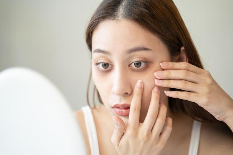 7 Penyebab Muka dan Kulit Tubuh Pucat Tiba-Tiba - Hello Sehat