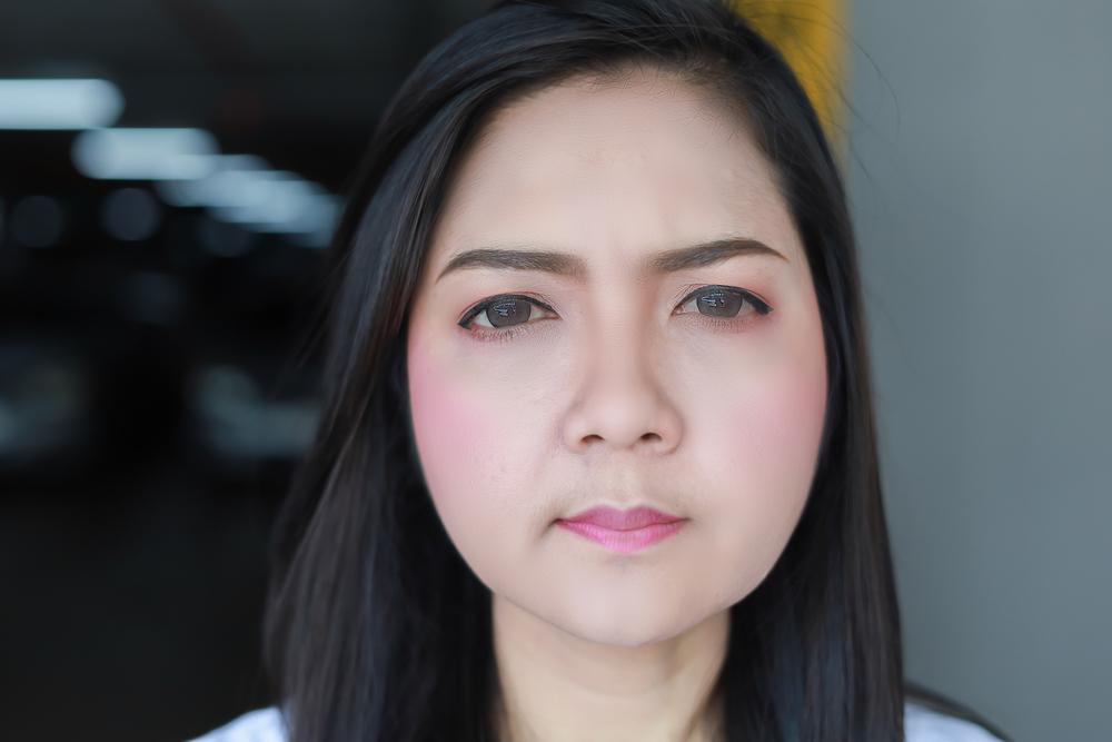 Moon Face: Gejala, Penyebab, Pengobatan, dll. - Hello Sehat