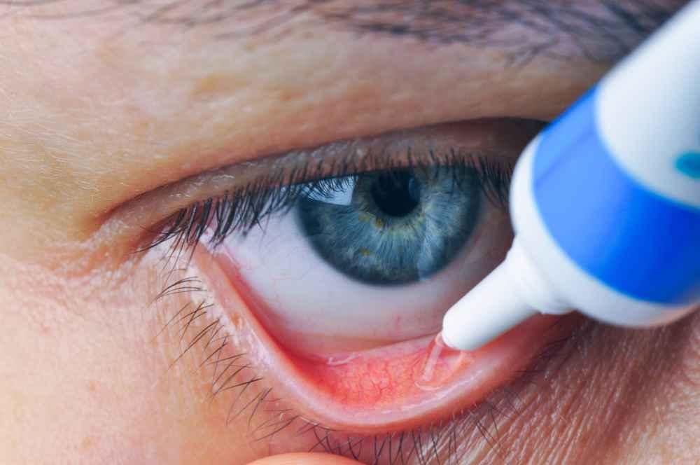 Erlamycetin: Kegunaan, Dosis, Efek Samping - Hello Sehat