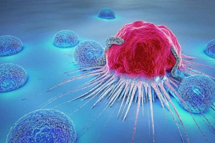 Mengenal 3 Jenis Tumor Berdasarkan Sifatnya - Hello Sehat