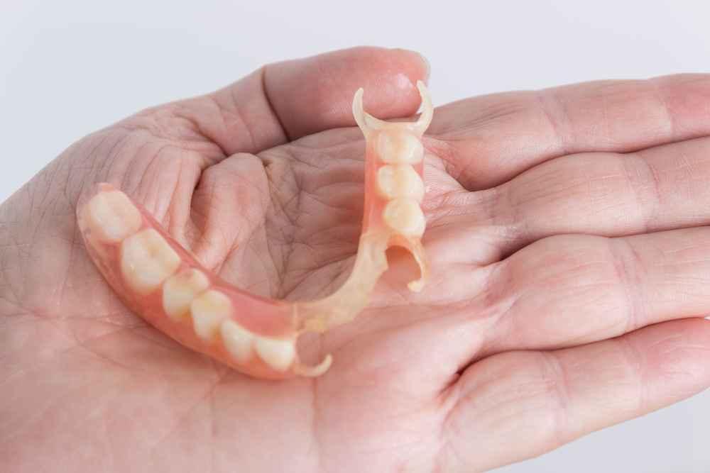 Gigi Palsu Valplast, Solusi Fleksibel untuk Senyum Indah - Hello Sehat