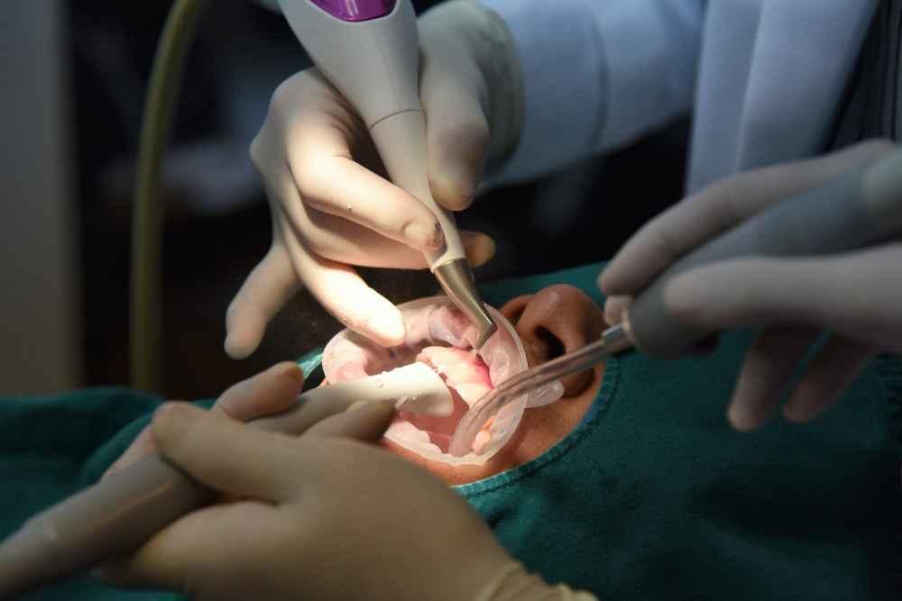 Gingivektomi: Definisi, Tujuan, Prosedur, dll. - Hello Sehat