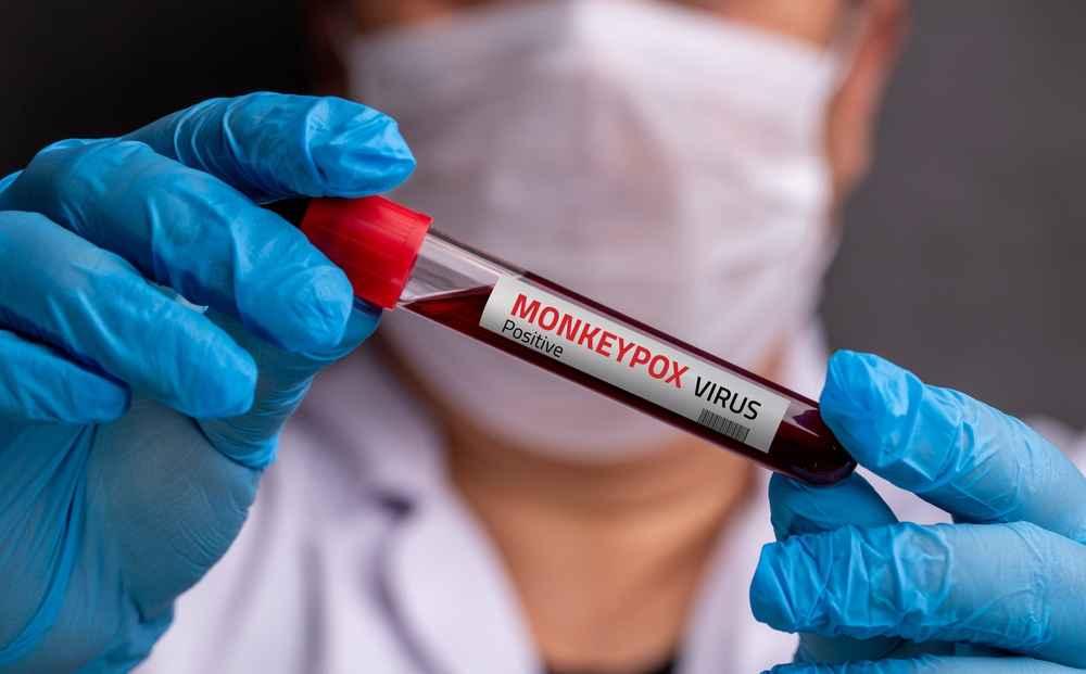 10 Langkah Pencegahan dan Pengendalian Mpox - Hello Sehat