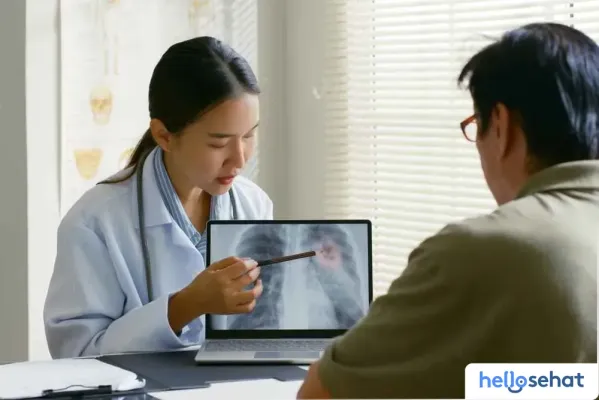 Ciri-Ciri Kanker Paru-Paru Stadium 4 dan Pengobatannya