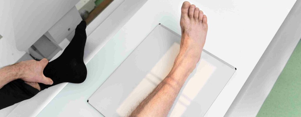 Rontgen Kaki: Tujuan, Prosedur Pemeriksaan, dan Hasil