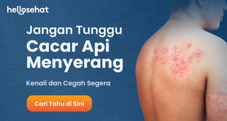 Kenali Cacar Api
