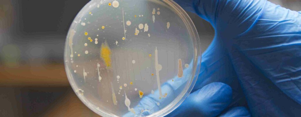 Ciri Air Terkontaminasi Bakteri Coliform dan Bahayanya