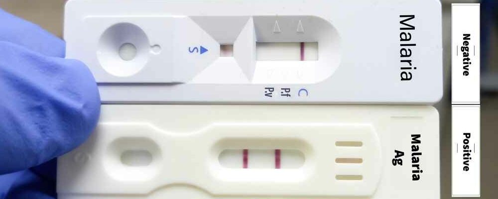 RDT Malaria: Definisi, Manfaat, Prosedur, dll. - Hello Sehat