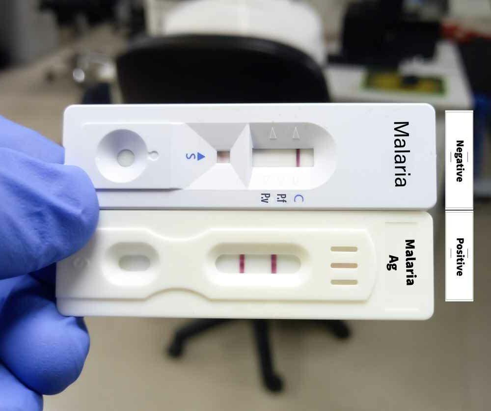 RDT Malaria: Definisi, Manfaat, Prosedur, dll. - Hello Sehat