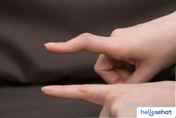 Dislokasi Jari Tangan: Gejala, Penyebab, Pengobatan, dll.
