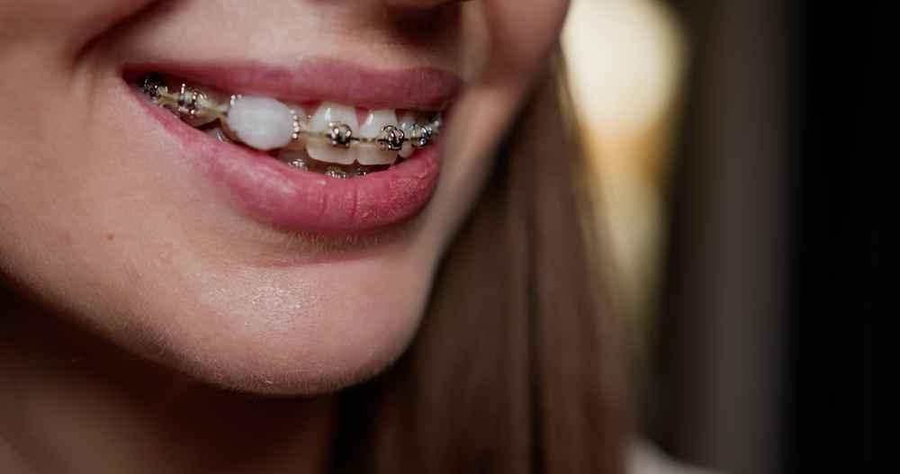 Ortho Wax: Manfaat, Cara Pakai, dan Perawatan - Hello Sehat