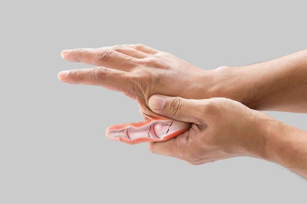 7 Penyebab Jempol Tangan Sakit dan Cara Mengatasinya