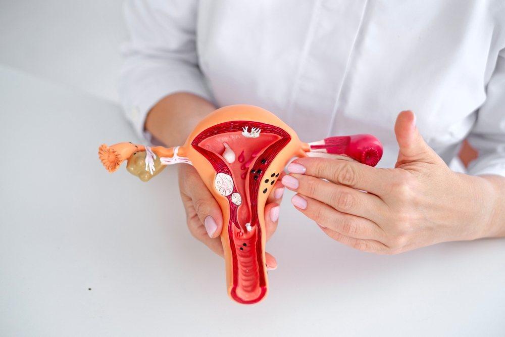Ovarium, Kenali Fungsinya dalam Sistem Reproduksi Wanita