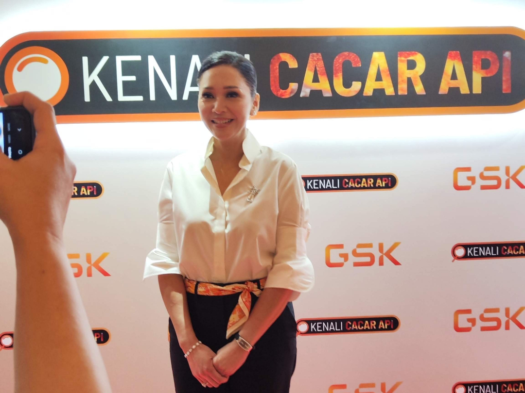 Menjelang Usia 50, Maia Estianty Jadi Duta Cacar Api