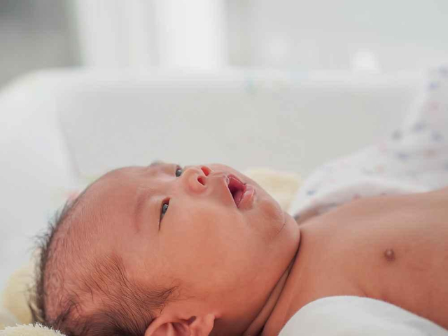 Pierre Robin Syndrome: Gejala, Penyebab, dan Pengobatan